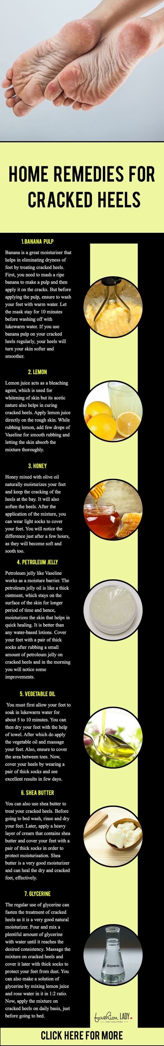 Home Remedies For Treating Dry Cracked Feet