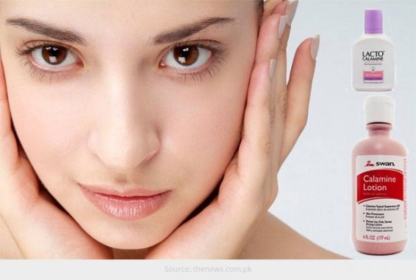 Calamine Lotion: Beauty Benefits And Uses