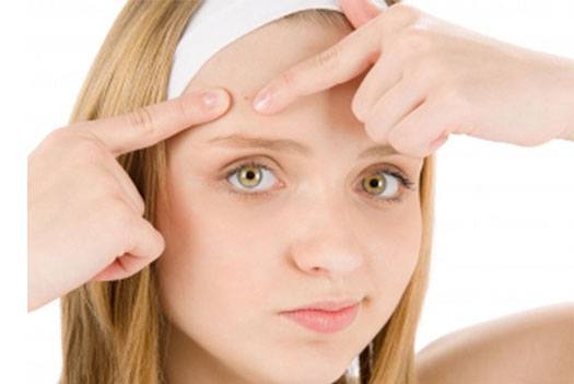 Possible Reasons Why Acne doesn't leave Your Face Possible Reasons Why Acne doesn't leave Your Face