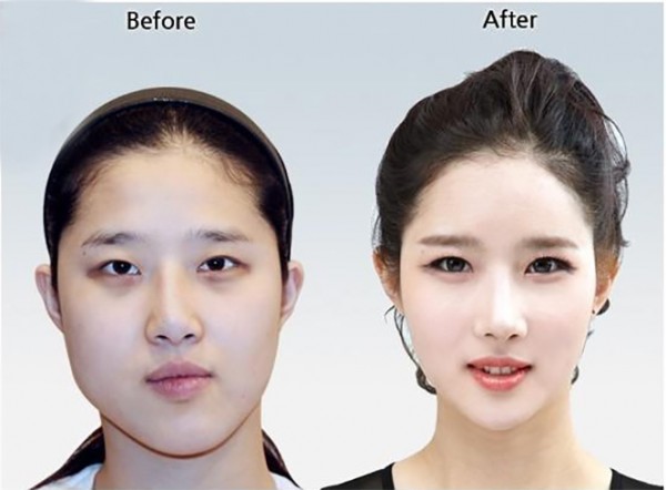 Japanese Facial Massage At Home - Bring Back That Firm Uplifted Face