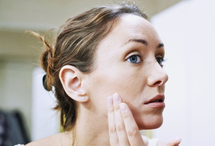 23 Simple Tips And Home Remedies To Get Rid Of Under Eye Wrinkles