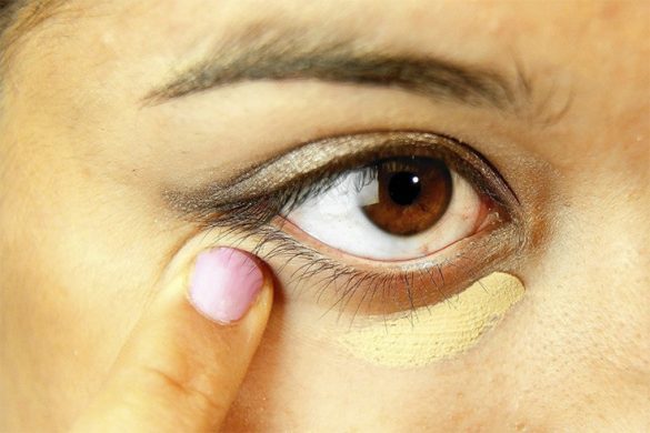 How To Get Rid Of Crow's-Feet Around Eyes