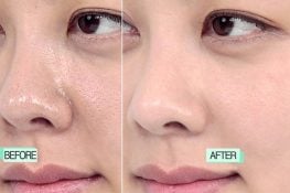 7 Ways to Use Orange Peel for Skin: Glowing Face Secrets