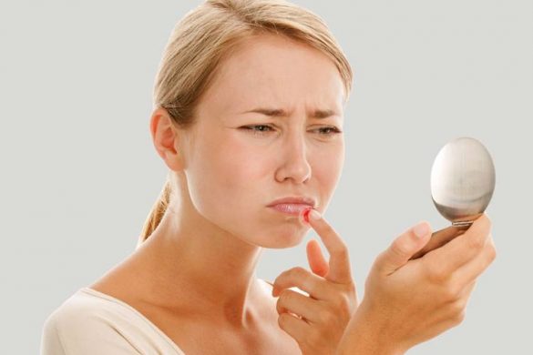 10 Best Ways To Get Rid Of Lip Pimples Fast