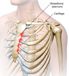 14 Causes Of Pain Under Right Rib Cage