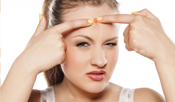 26 Home Remedies To Get Rid Of A Sebaceous Cyst