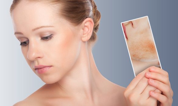 The Best 15 Benefits Of Applying Milk On Face Daily